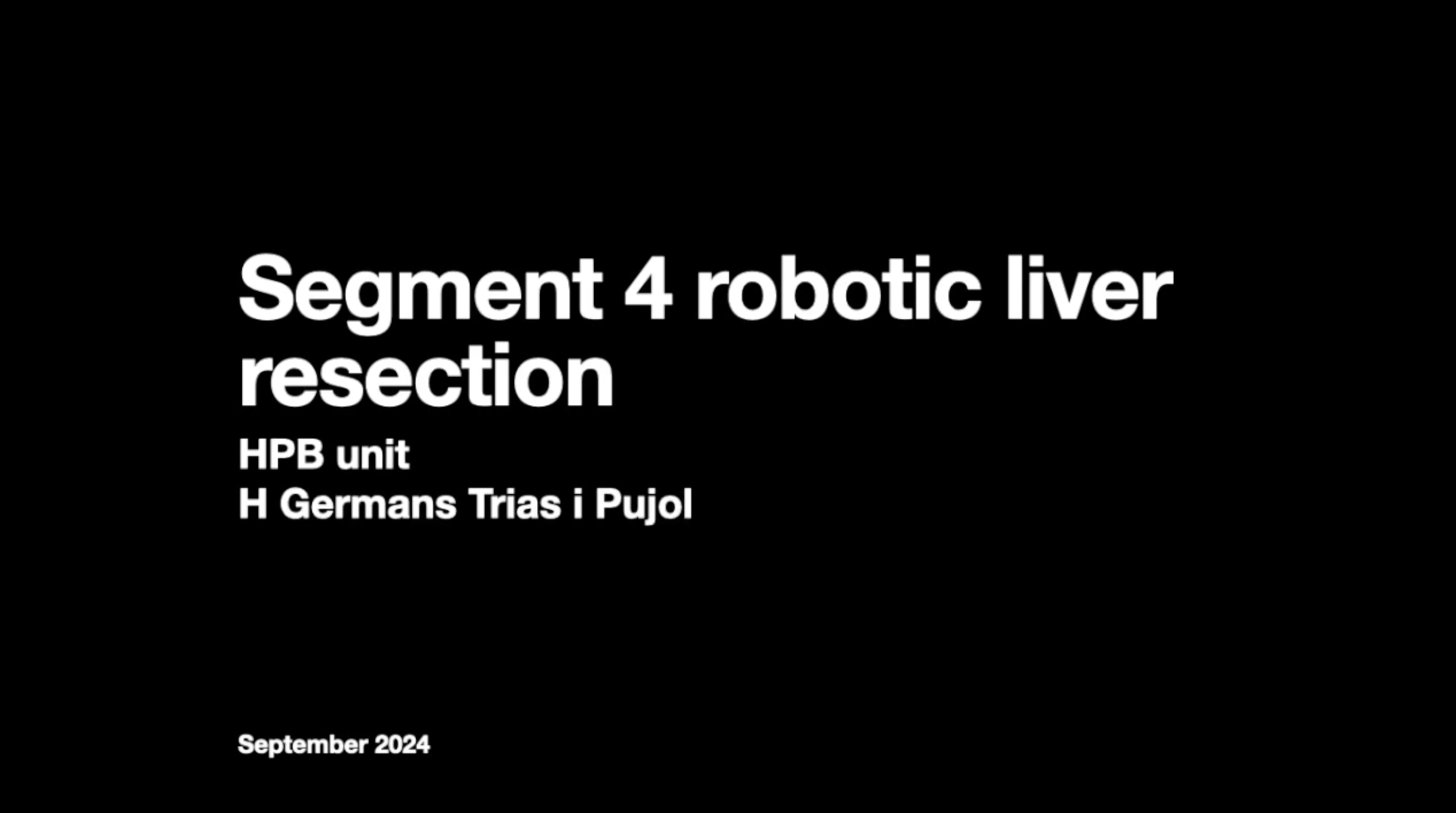 Segment 4 robotic liver resection - HPB Can Ruti